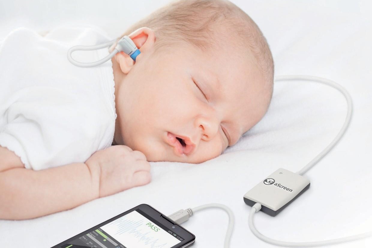 KỸ THUẬT ĐO VÀ ĐỌC KẾT QUẢ OAE, ABR, ASSR | Viện Y Dược Lâm Sàng
